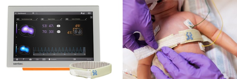 Collaboration and innovation in Pulmonary Medicine | McGovern Medical ...